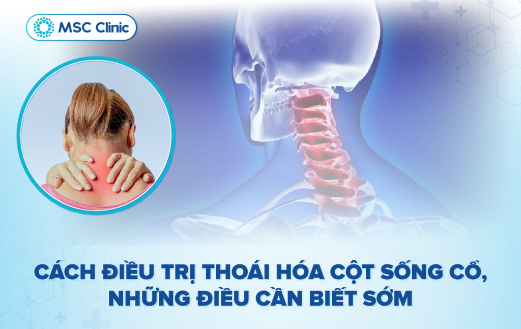 Cách điều trị thoái hóa cột sống cổ và những điều cần biết sớm - MSC Clinic