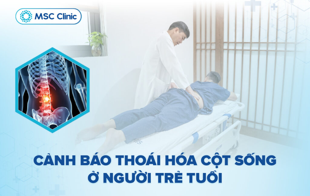 Cảnh báo thoái hóa cột sống ở người trẻ tuổi - MSC Clinic