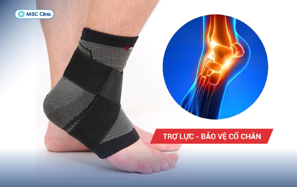 Đứt dây chằng cổ chân và phương pháp điều trị hiệu quả - MSC Clinic
