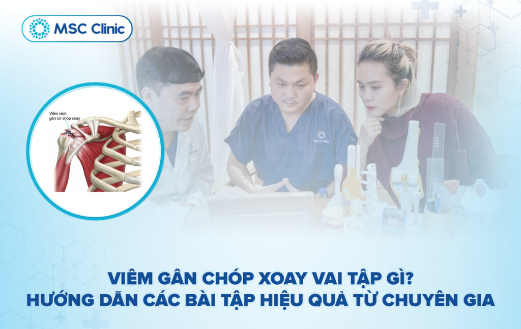 Viêm gân chóp xoay vai tập gì? Hướng dẫn các bài tập hiệu quả từ chuyên ...
